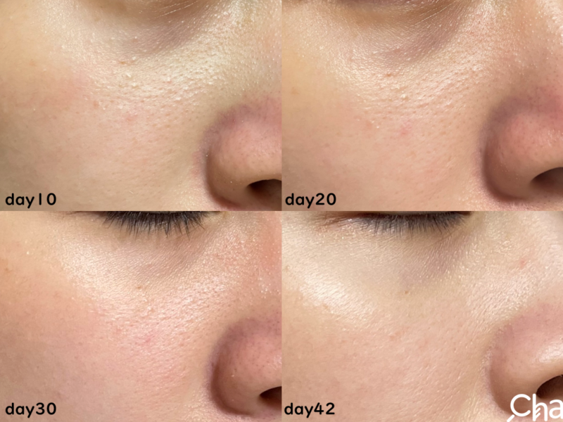 IPSA ME自律循環液42天保養實測！怎麼選＆用法＆網路評價整理 – 找Cha研究室